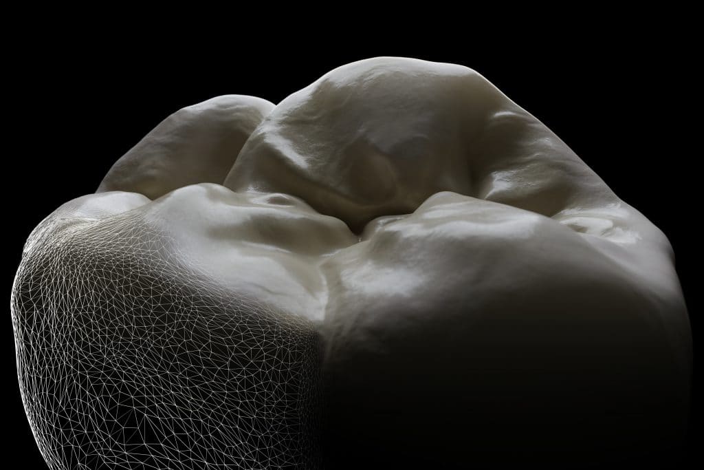 Overland Park Dentist Restores Smiles With Customized Crowns | Overland ...